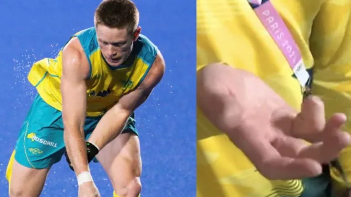 ஒலிம்பிக்கில் பங்கேற்பதற்காக காயமடைந்த விரலை வெட்டி எறிந்த ஆஸ்திரேலிய ...